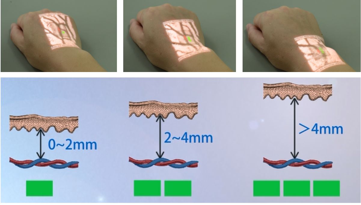 VEINCAS Vein Finder V800p